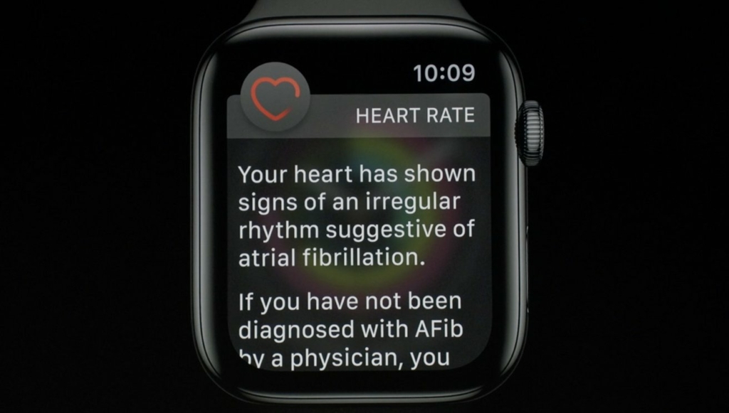 AppleWatch-afib-warning - MacTrast